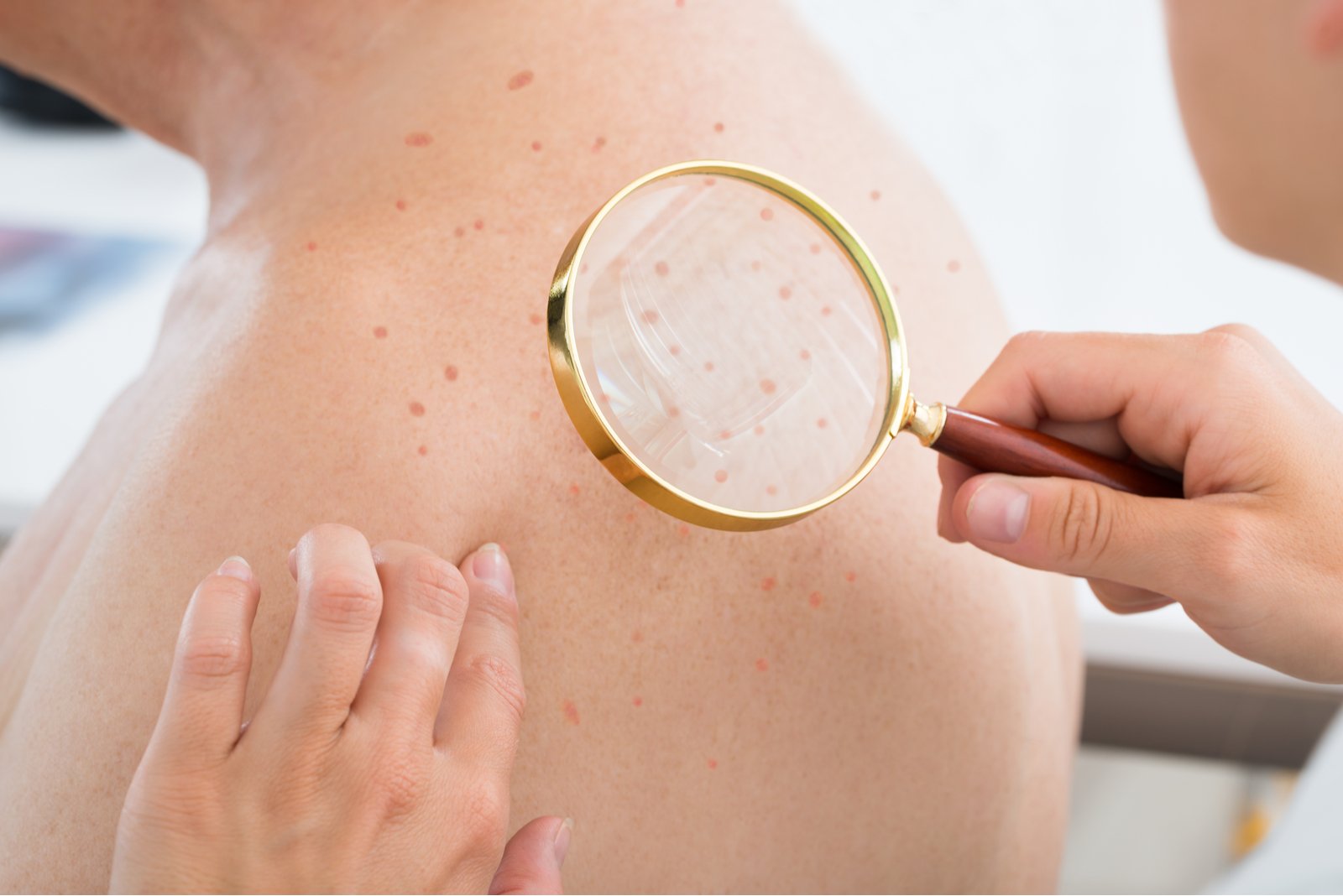 Dermatologist Orlando | Medical & Cosmetic Dermatology - Derrow Dermatology